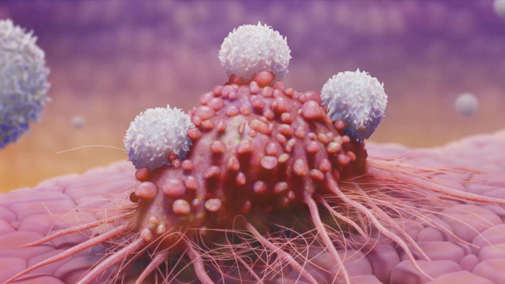 HEALTH 30 Everyday Activities That Can Cause Cancer The Milli Chronicle